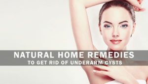 Armpit Cyst and Learn How to Treatment of Underarm Cyst