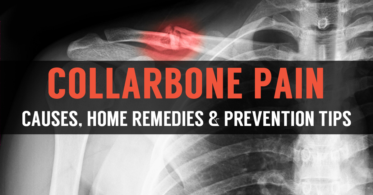 Never Ignore Collarbone Pain Or Injuries If Hurt Longer Never Ignore Collarbone Pain Or Injuries If Hurt Longer